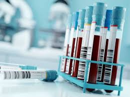 Abu Dhabi Launches Trucheck™ Intelli Blood Test to Detect 70+ Cancers ...